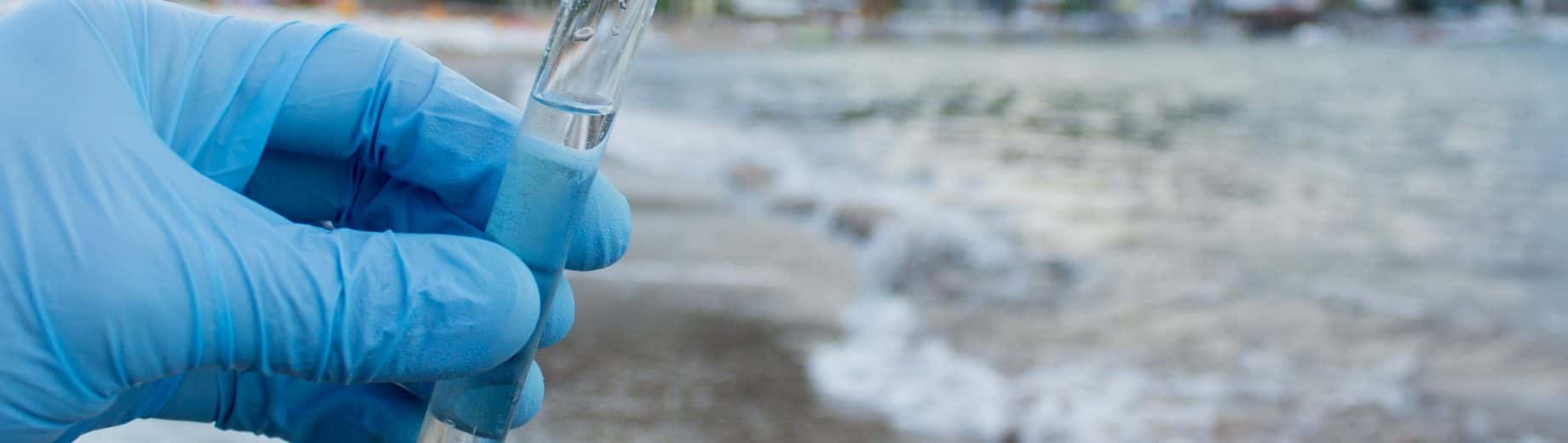 42 Pandemic Facts About Cholera - Factinate