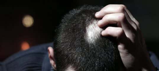 Fiery Facts About Charles II, The Bewitched King Of Spain - Factinate