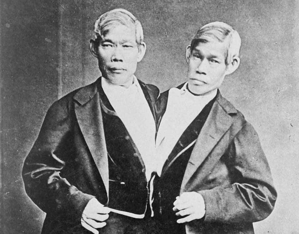 The Original "Siamese Twins" Met An Awful End