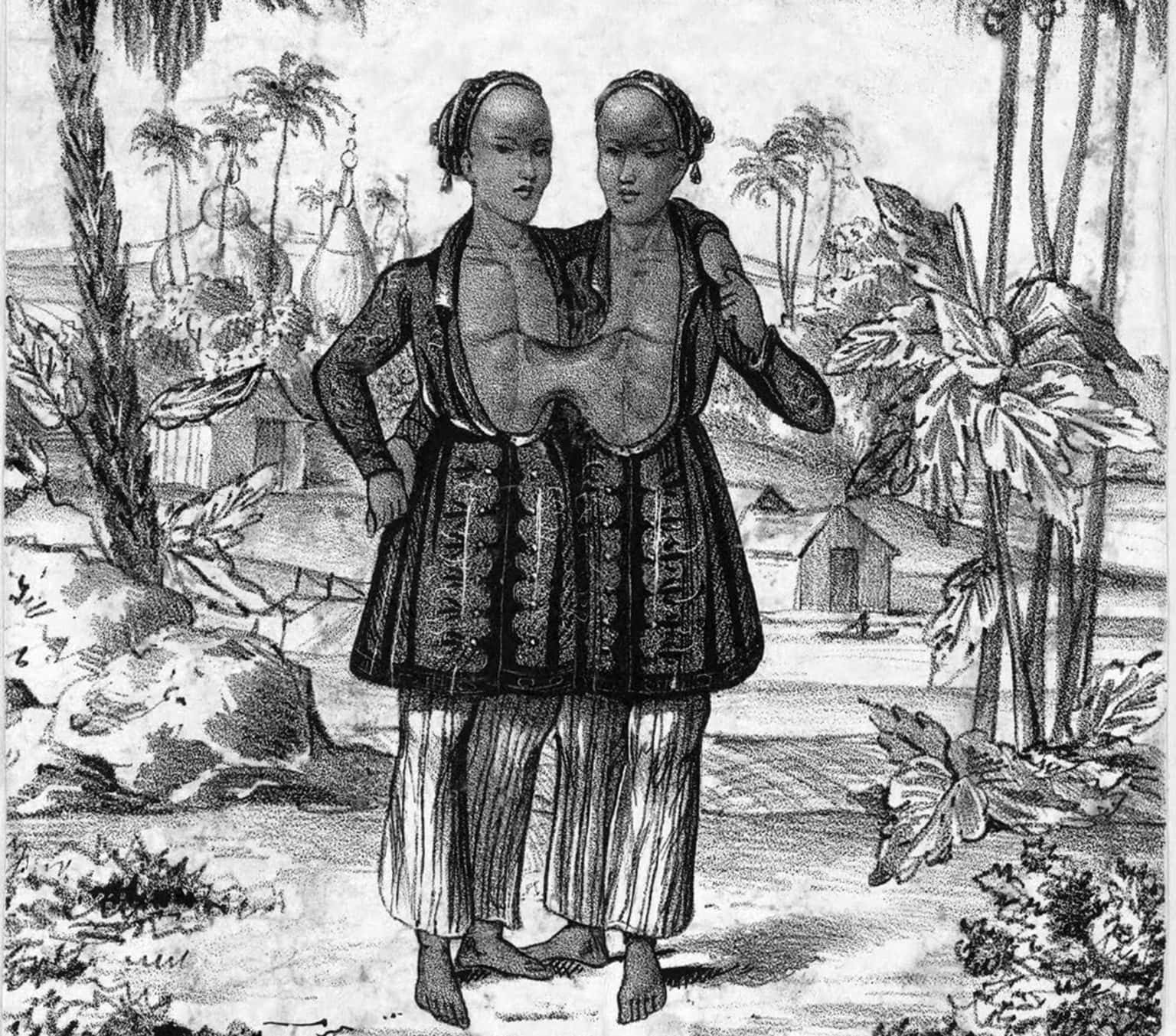 The Original "Siamese Twins" Met An Awful End