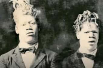Twisted Facts About the Muse Brothers, The Heartbreaking Circus Act ...