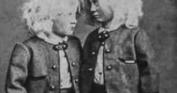 Twisted Facts About the Muse Brothers, The Heartbreaking Circus Act ...