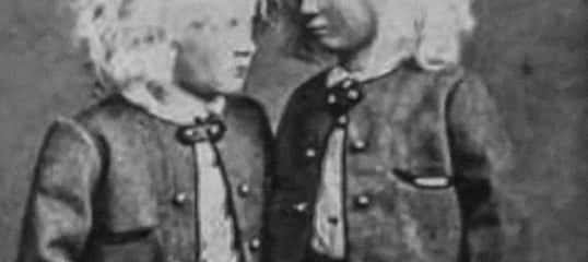 Twisted Facts About the Muse Brothers, The Heartbreaking Circus Act ...