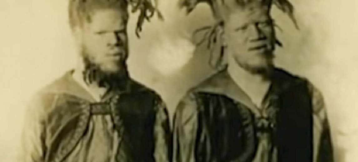 Twisted Facts About the Muse Brothers, The Heartbreaking Circus Act ...