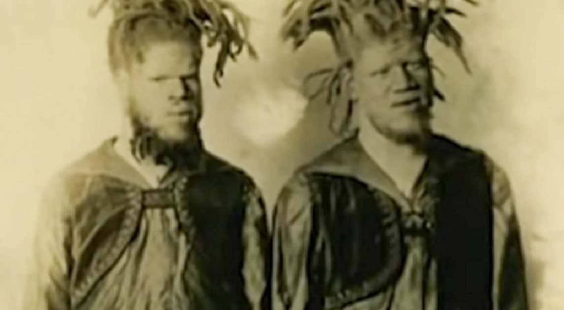 Twisted Facts About the Muse Brothers, The Heartbreaking Circus Act ...