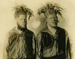 This Exploited Circus Act Got Their Revenge