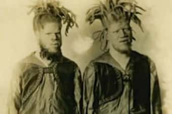 Twisted Facts About the Muse Brothers, The Heartbreaking Circus Act ...