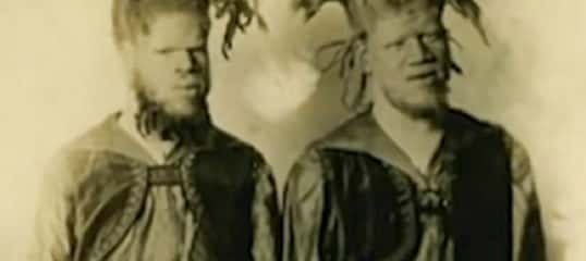 Twisted Facts About the Muse Brothers, The Heartbreaking Circus Act ...