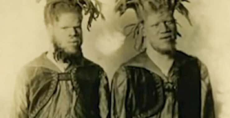 Twisted Facts About the Muse Brothers, The Heartbreaking Circus Act ...