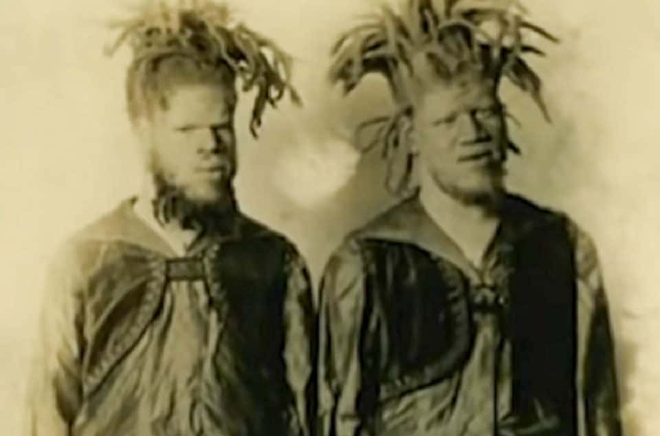 Twisted Facts About the Muse Brothers, The Heartbreaking Circus Act ...