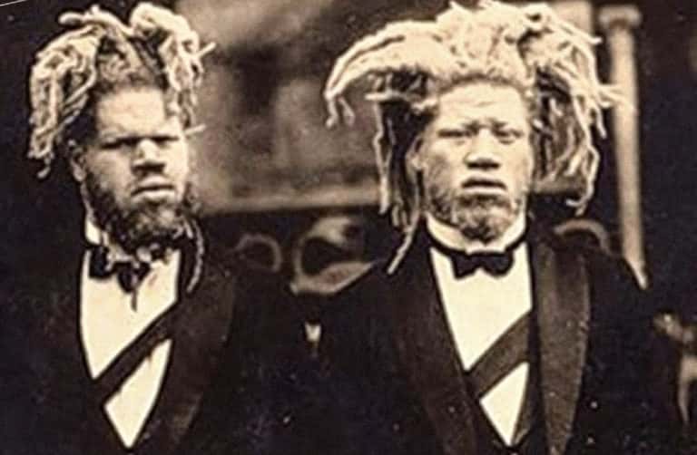 This Exploited Circus Act Got Their Revenge