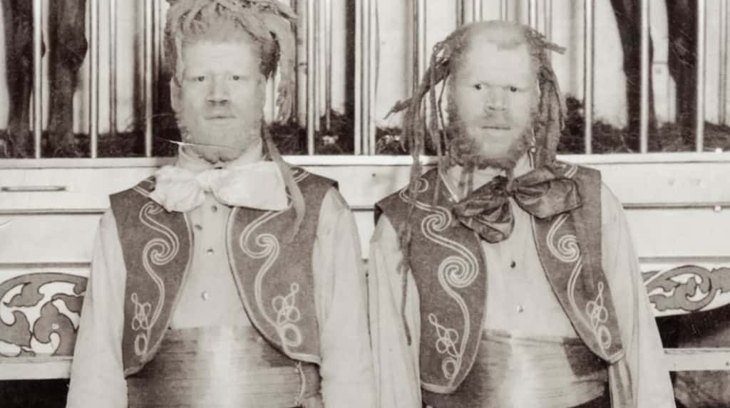 This Exploited Circus Act Got Their Revenge