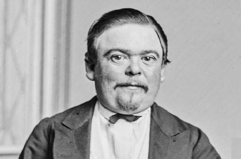 Larger-Than-Life Facts About Charles Stratton, General Tom Thumb ...