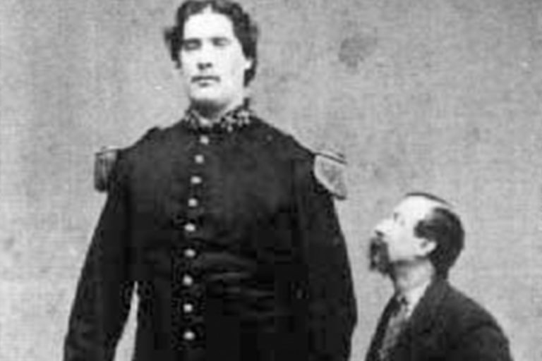 History’s Most Tragic Giantess