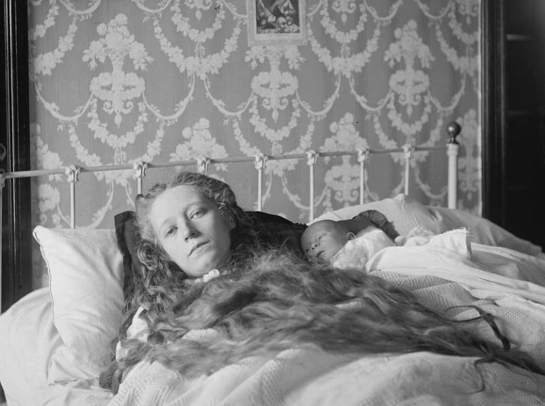 Myrtle Corbin, The Four-Legged Woman Of Texas