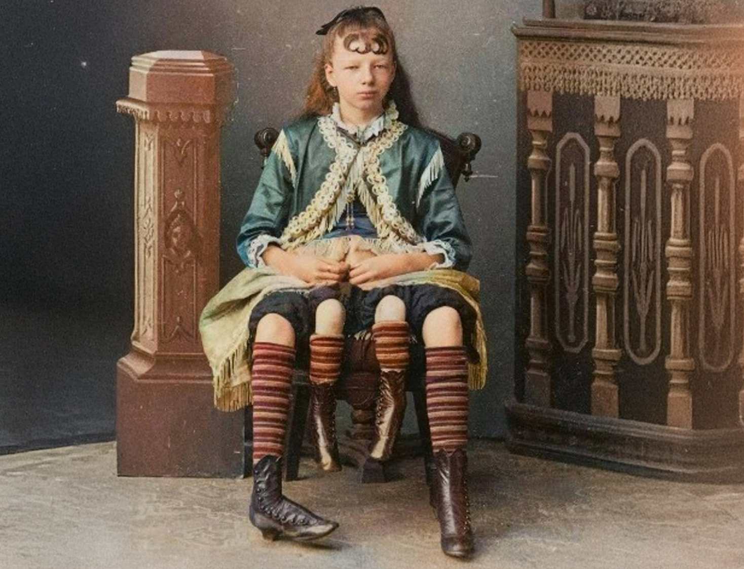 Myrtle Corbin, The Four-Legged Woman Of Texas