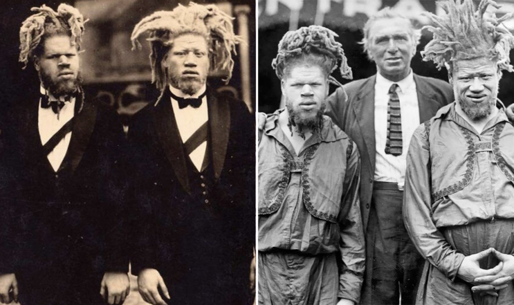 This Exploited Circus Act Got Their Revenge