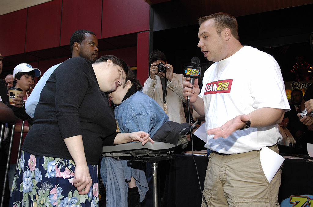 Conjoined Twins: Lori and George Schappell