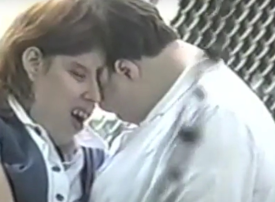 Conjoined Twins: Lori and George Schappell