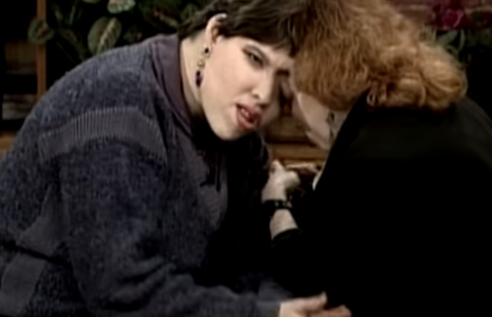 Conjoined Twins: Lori and George Schappell