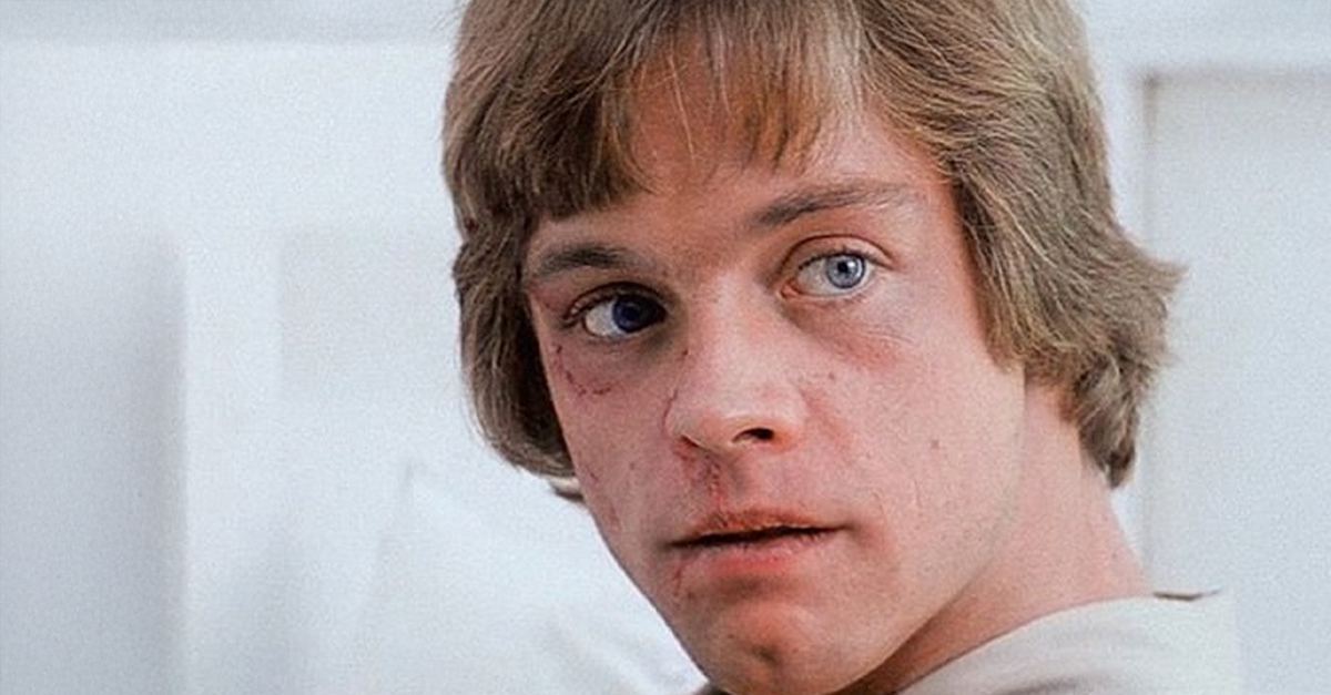 Famous Actors With Scars, And How They Got Them