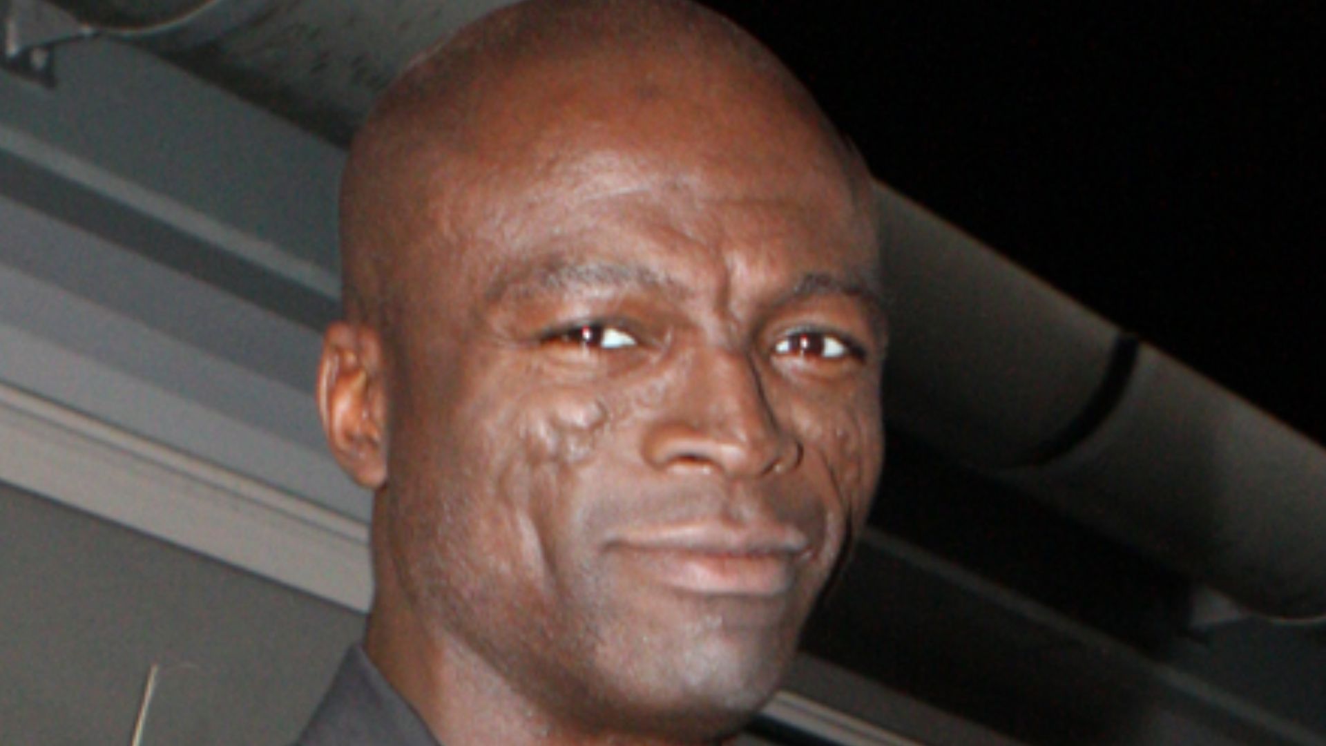 Famous Actors With Scars, And How They Got Them