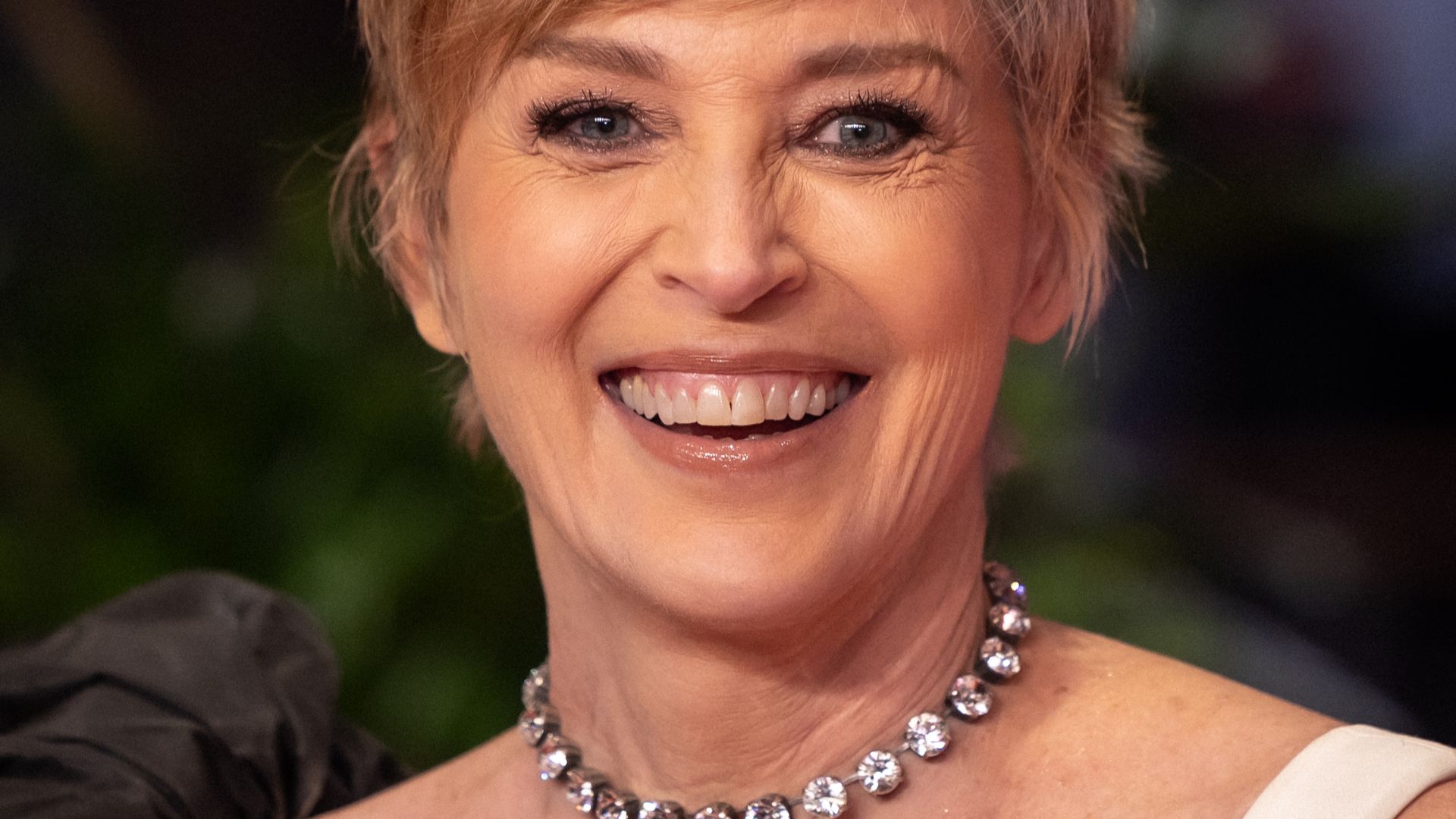 Famous Actors With Scars, And How They Got Them