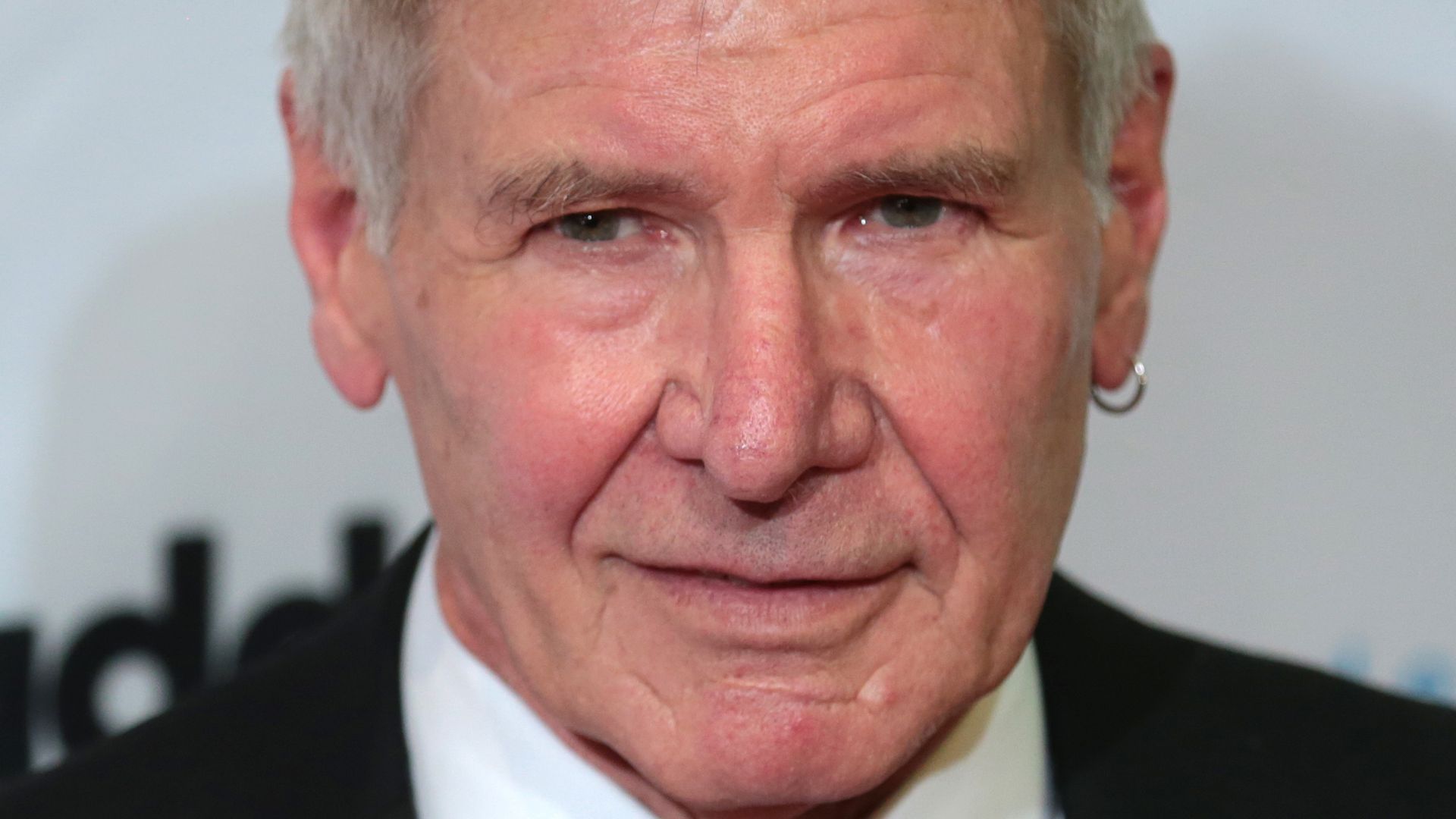 Famous Actors With Scars, And How They Got Them