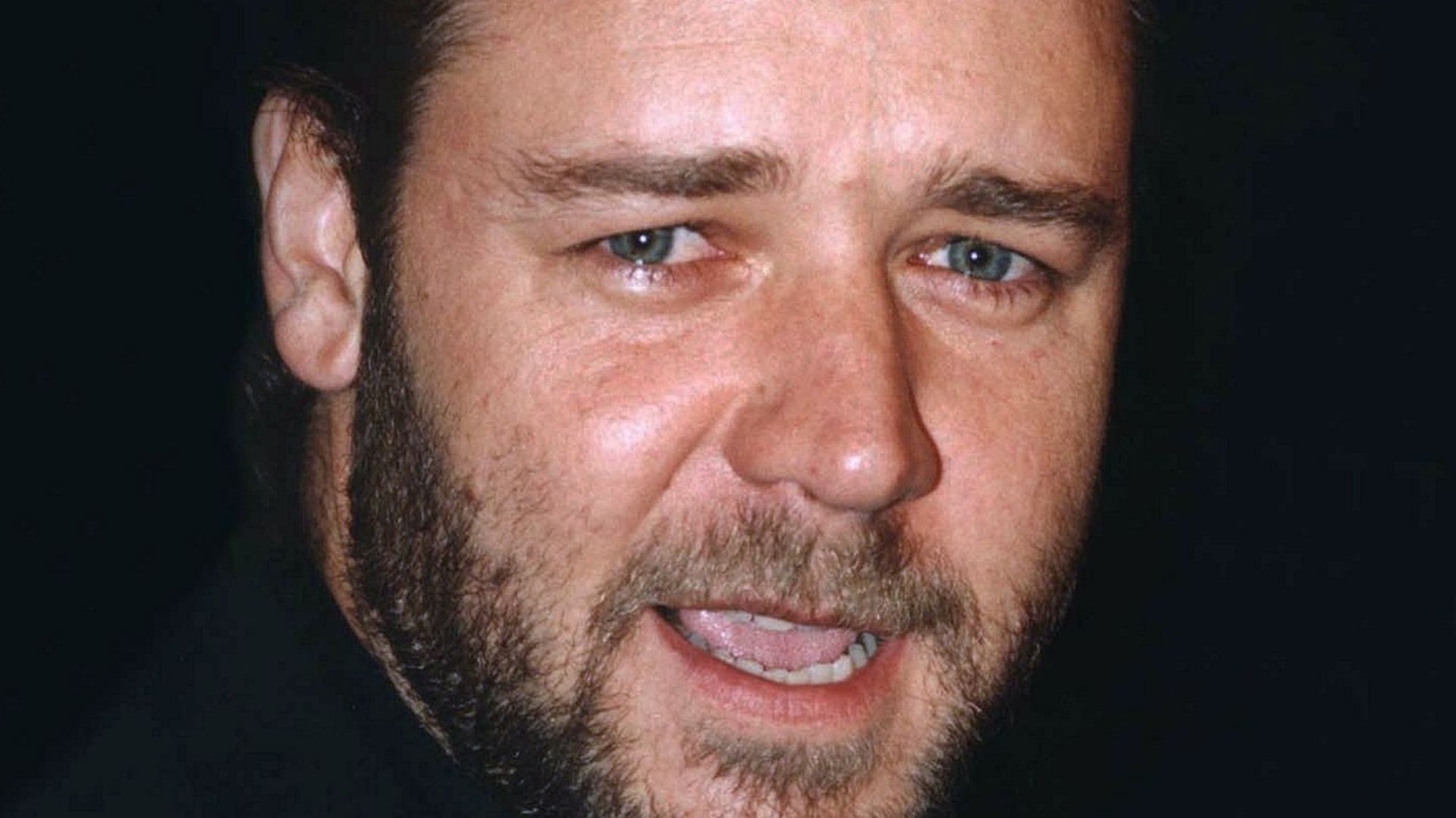 Famous Actors With Scars, And How They Got Them