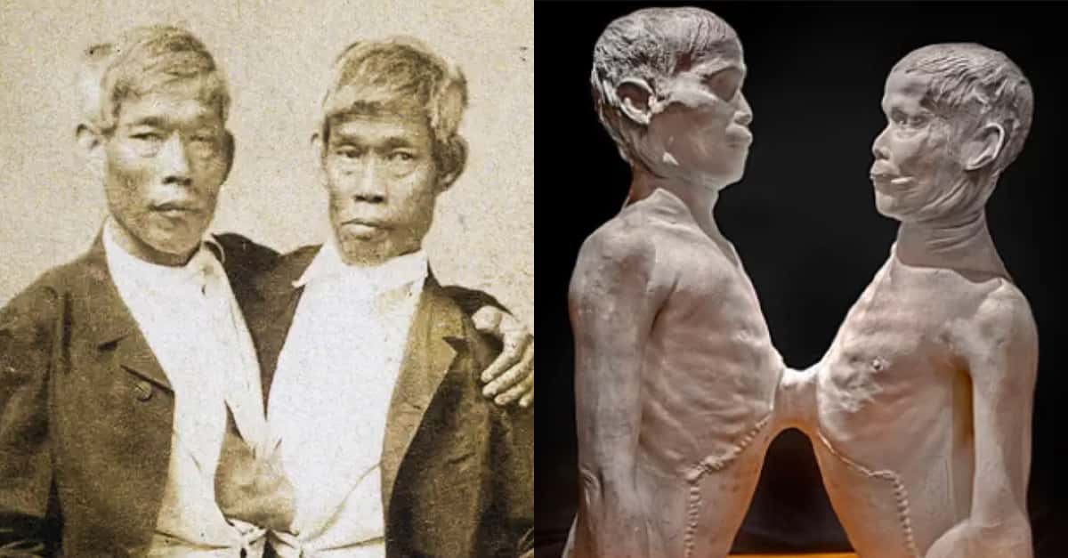 Conjoined Facts About Eng And Chang Bunker, The Original “Siamese Twins”