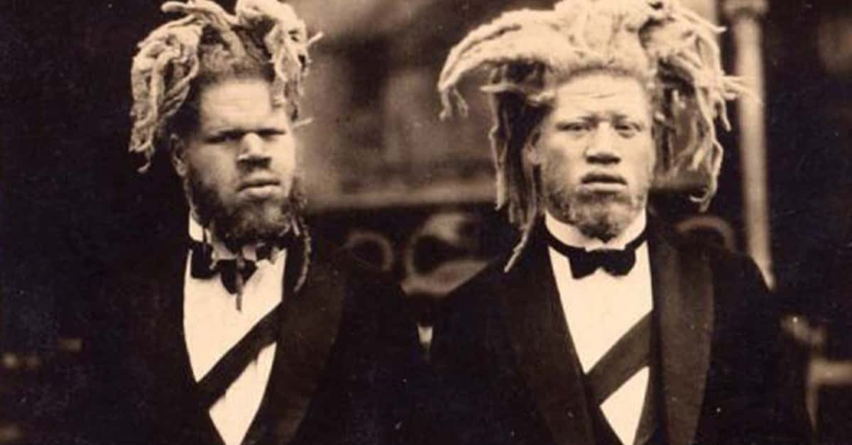 Twisted Facts About the Muse Brothers, The Heartbreaking Circus Act